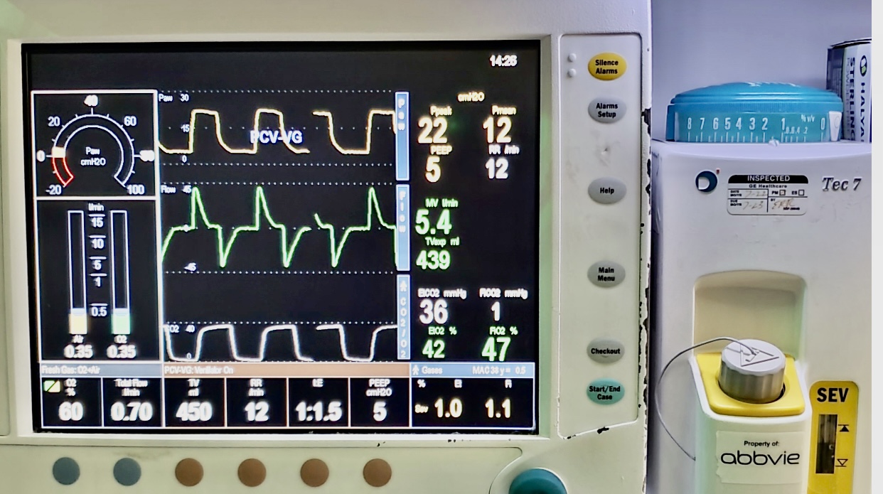 Conserving Oxygen - Integrated Anesthesia Associates